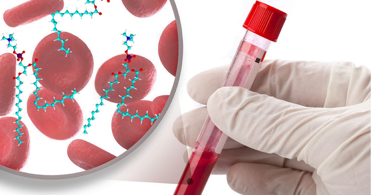 MTBE Lipid Extraction - Protocol - OneLab MTBE Lipid Extraction - Protocol - OneLab