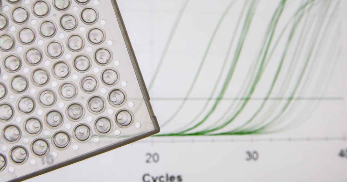 Single-Step SYBR® Green RT-qPCR - Protocol - OneLab